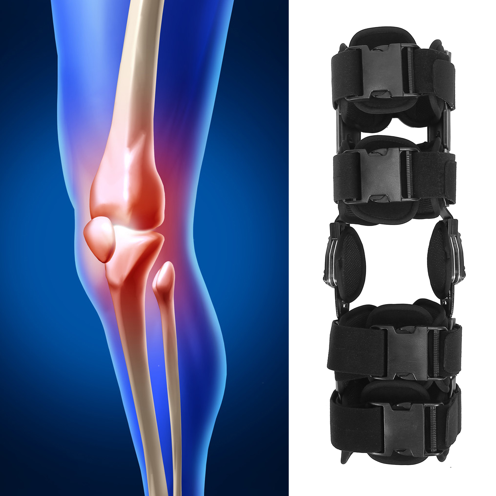 ANGGREK Hinged Knee Brace Postoperation Knee Recovery Stabilizer ...