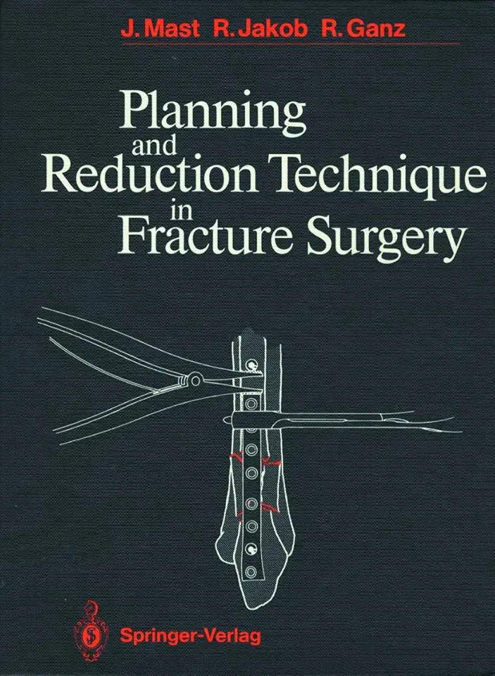Planning and Reduction Technique in Fracture Surgery - Arizona Outlet